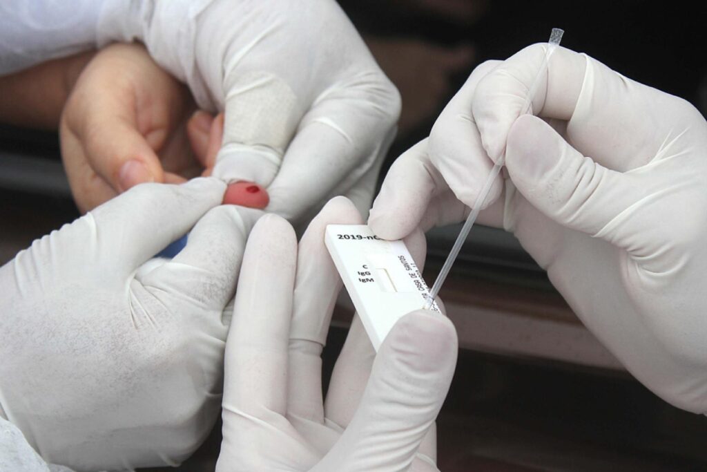Mooca já tem o Teste do Coronavirus Com Resultado na Hora – Rede ...